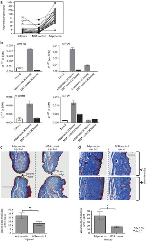 In Vivo Effects Of Adiponectin On Epithelialization A Adiponectin Download Scientific