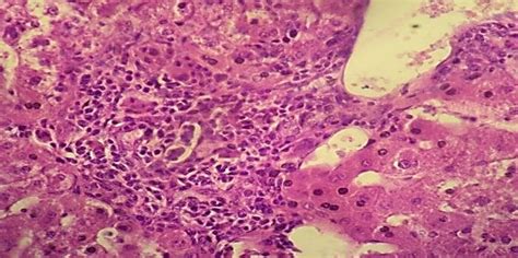 Hepatic Tissues Of Group D Which Were Obtained From Rats Were Download Scientific Diagram