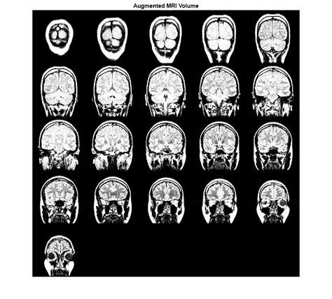 jitterintensity randomly augment intensity of grayscale image or