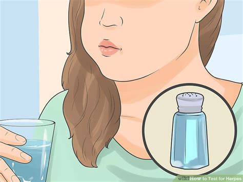 3 Ways To Test For Herpes WikiHow