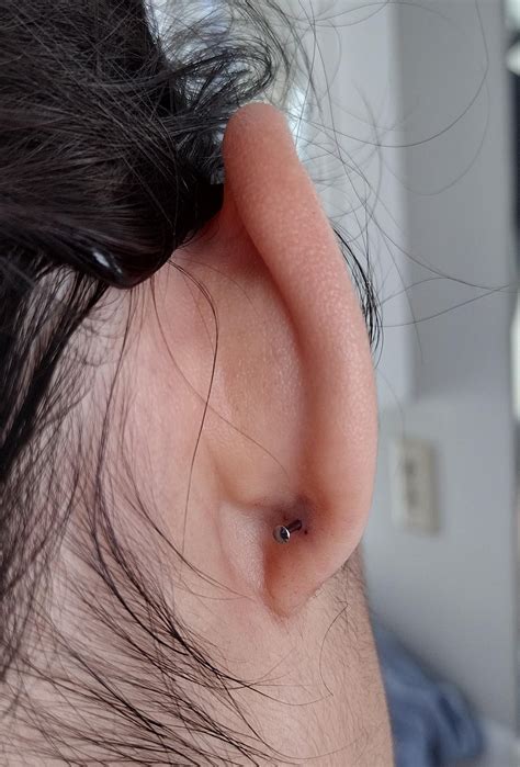 Got My Ear Repierced And Dealing With Issues Rpiercing