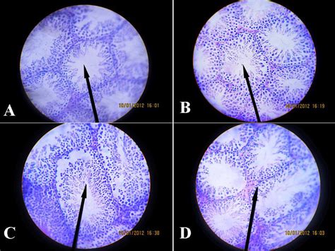Histopathological Observation In The Testicular Tissue Of Male Albino