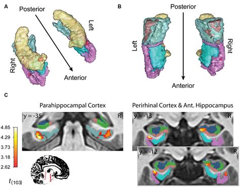 Frontiers Hippocampal Subfield And Medial Temporal Cortical