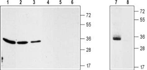 Vdac Polyclonal Antibody Avc 001 200ul