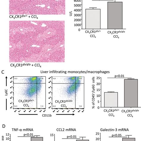Cx 3 Cr1 Deficiency Worsens Liver Injury And Lobular Inflammation