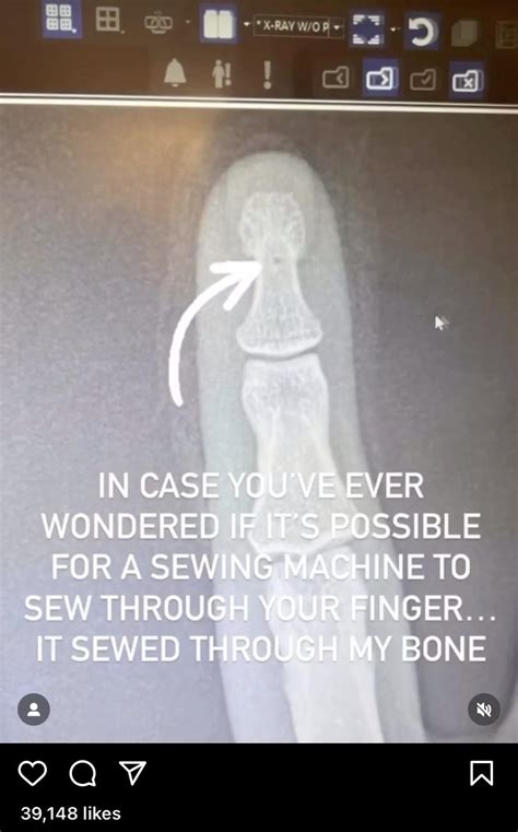 Weak Ass Mf Rneverbrokeabone