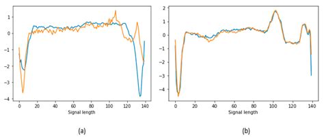 Unsupervised Transformer Based Anomaly Detection In Ecg Signals