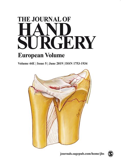 Morphological Characteristics Of The Sigmoid Notch Of The Distal Radius Affect The Stress