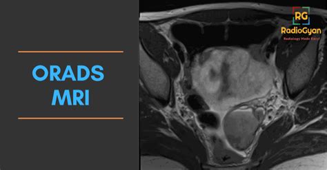 Orads Mri Radiogyan