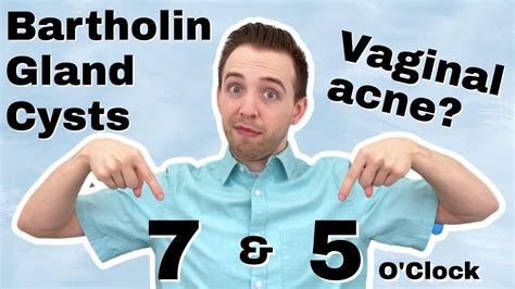 How To Soften A Bartholin Cyst At Gary Delariva Blog