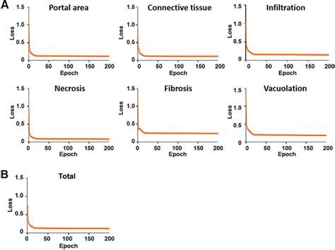 Total Training Loss During Training Of Single And Multiple Finding