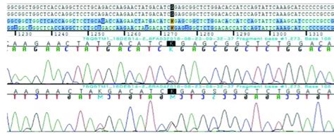 sanger sequenced chromatograms for sequestosome 1 gene sqstm1