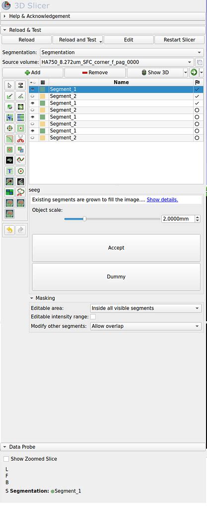 How To Add Additional Buttons To Scriptedsegmenteditoreffect Development 3d Slicer Community
