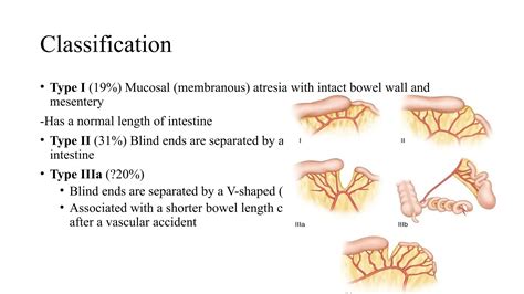 Approach To Neonatal Intestinal Obstruction Pptx Pregnancy Reproductive Health