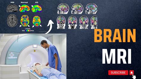 Brain Mri Process How To Do A Head Mri Mlox Del