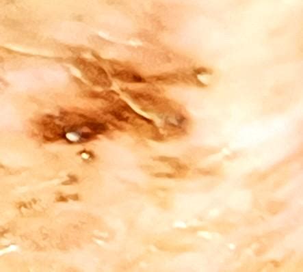 What Is This Bug R Whatsthisbug