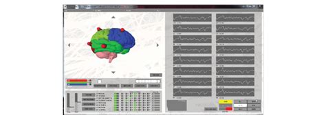 The Spectrogram Module For The Delta Waves Download Scientific Diagram