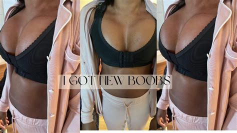 Breast Augmentation 1 Week Post Op Recovery 500cc Silicone Implants