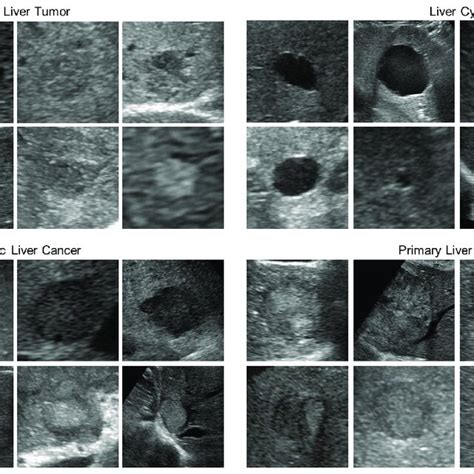 Example Of Test Images Each B Mode Ultrasound Image Is A Grayscale Download Scientific Diagram