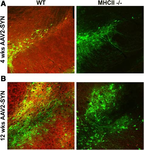 Mhcii Is Required For α Synuclein Induced Activation Of Microglia Cd4 T Cell Proliferation And