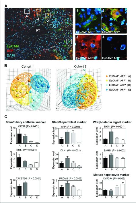 Molecular Features Of Hcc Subtypes Defined By Epcam And Afp Expression