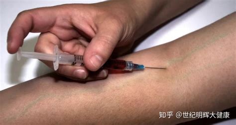 每 3 个成年人就有 1 个得的病，体检单的这个指标就是警报 知乎