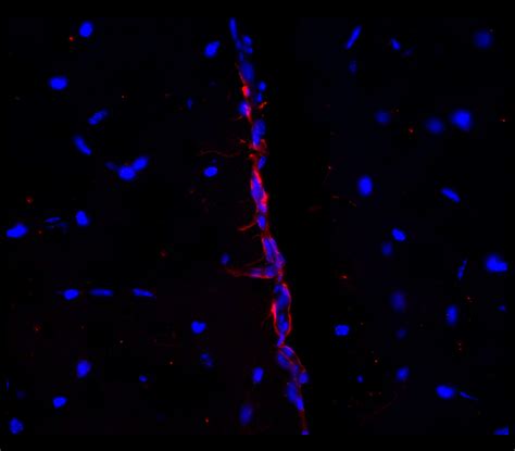 Neural Progenitors Marker Antibody Panel Irap5015 Ireal Biotechnology Inc