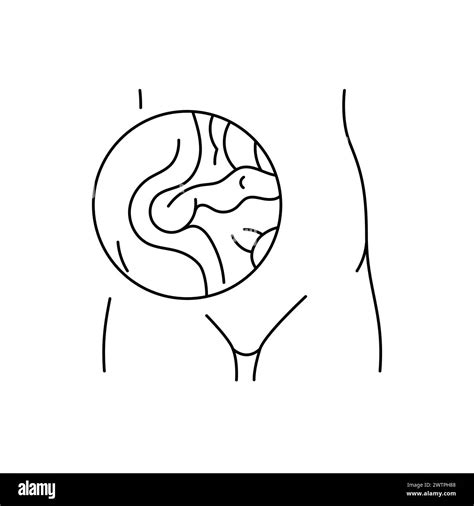 Ventral Hernia Line Icon Vector Isolated Element Editable Stroke Stock Vector Image And Art Alamy