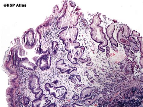 Hsp Atlas Histopathology Atlas Gi Tract