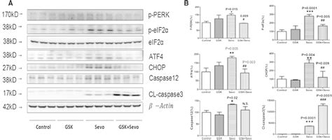 A Selective Inhibitor Of Perk Kinase Gsk2656157 Gsk Inhibited