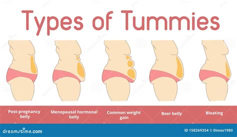 Types Of Female Tummies Banner Stock Illustration Illustration Of
