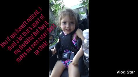 Polymicrogyria 🤔 Youtube