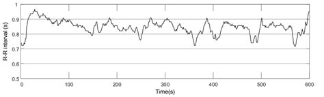 r r intervals calculated based on the ecg signal which is collected