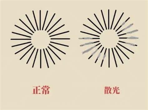 散光怎么治疗收费标准治疗价格费用 睛安士眼科