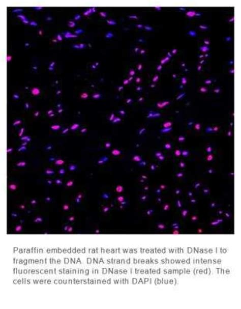 Novus Biologicals™ Onestep Tunel Apoptosis Kit Red 555 20 Assays