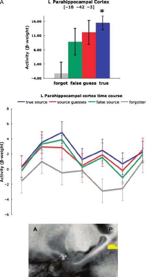 A Activation Identified In Left Parahippocampal Cortex Sagittal