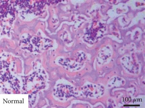 Hande Staining Of Defect Sites Of A Rat Model Of Calvarial Critical