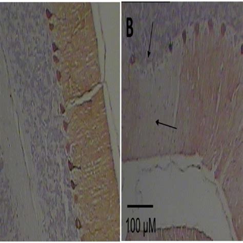 Immunohistochemical Staining Of Calbindin In 4 µm Thick Download Scientific Diagram