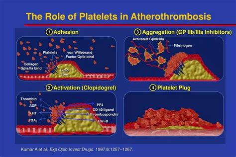 Ppt The Role Of Platelets In Atherothrombosis Powerpoint Presentation