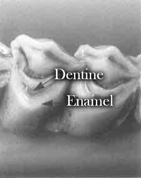 Aging Deer North Dakota Game And Fish