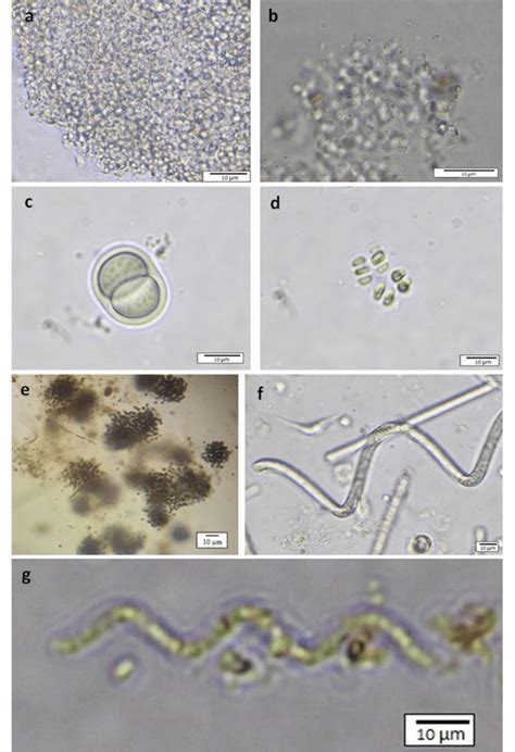 Cyanobacteria A Aphanothece Floccosa B Gloeothece Subtilis C