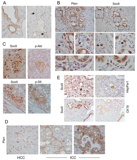 Sox9 Expressing Cells In DKO Livers A IHC Analyses Of DKO Non Tumor