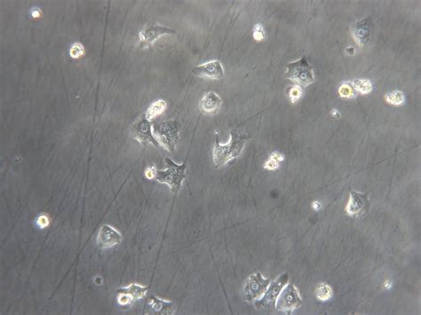 Primary Hepatocytes Human Hepatocytes AXOL Bioscience