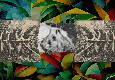 Vg Med If Lungs Bronchi Traction Bronchiectasis Subpleural Sparing