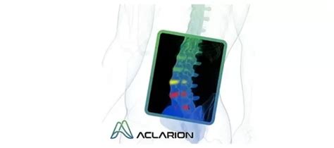Atec Launches Ptp™ Corpectomy The Next Evolution Of Lateral Approach