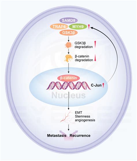 SAMD9 Promotes Postoperative Recurrence Of Esophageal Squamous Cell
