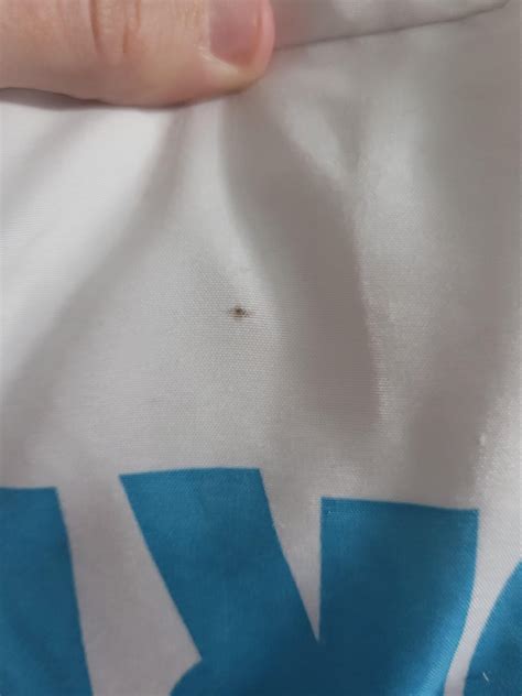 do these look like bed bug marks on the sheets r bedbugs