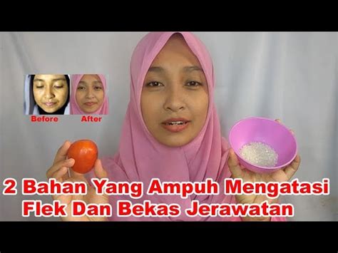 5 Rahasia Terbukti Manfaat Tomat Campur Gula Untuk Wajah Biotifor