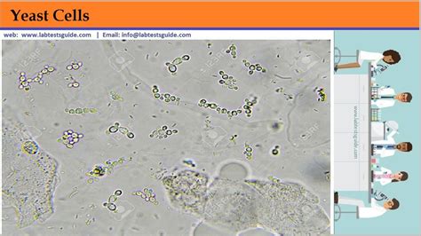 Yeast In Urine Test What Does Yeast Cells In Urine Mean