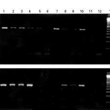 Specificity Of Primer Sets For Amplification Of 16s RRNA Gene Sequence Download Scientific